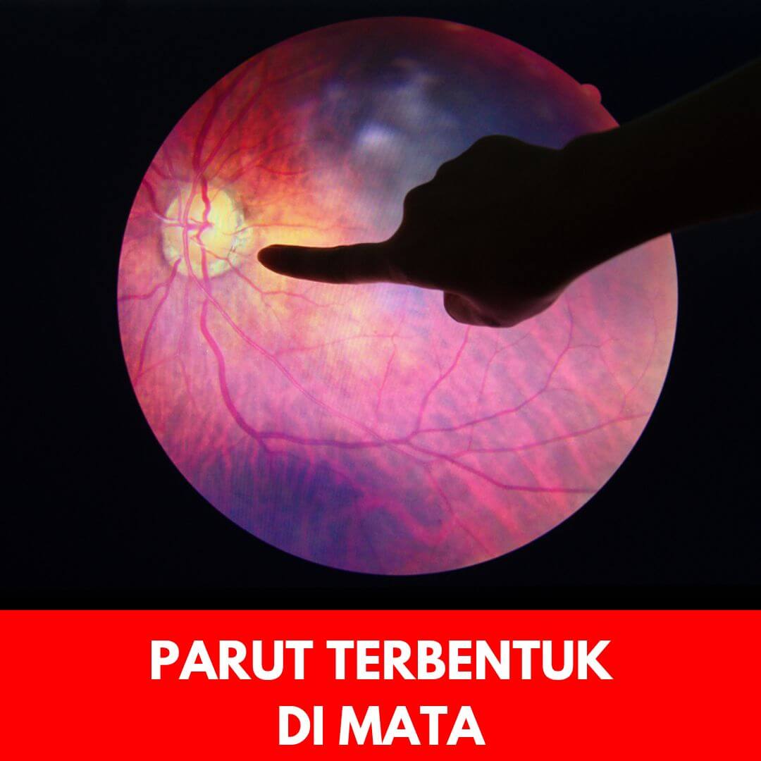 100% Tumbuhan Organik Khas Untuk Kawal Bacaan Gula & Rabun