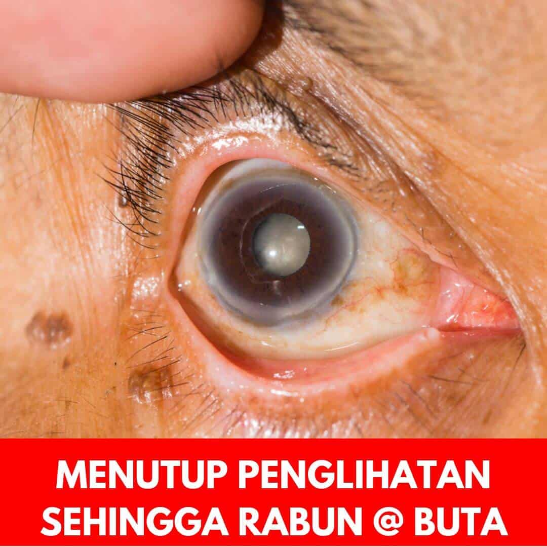 100% Tumbuhan Organik Khas Untuk Kawal Bacaan Gula & Rabun
